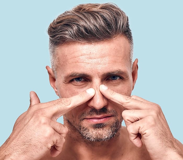 What Exactly is Rhinoplasty Surgery? | Mark Solomos